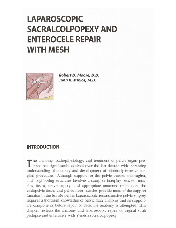 Hysteropexy Patient Resources Atlanta | Vaginal Vault Repair Scientific ...